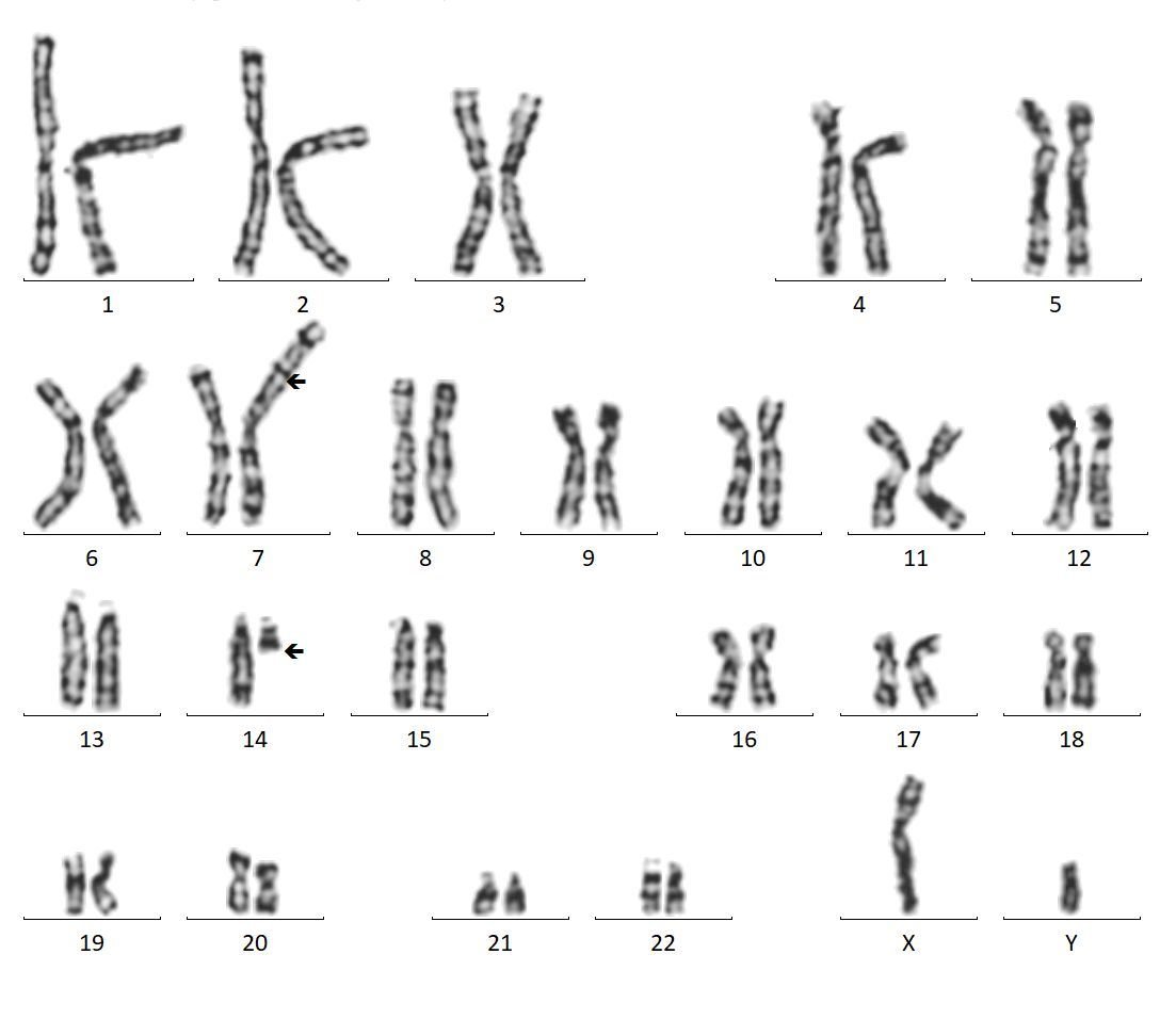 Karyotyping Genetic Test - Krishna IVF Clinic