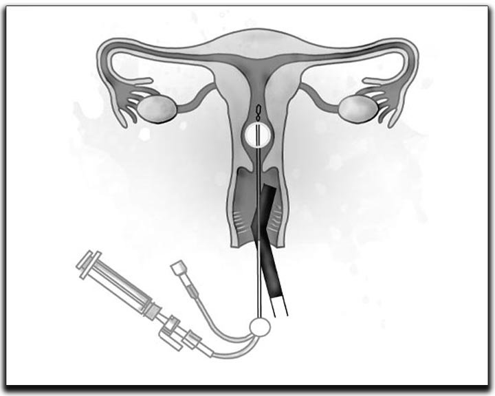 Basic Services in IVF Clinic - Krishna IVF Clinic