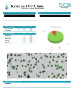 DNA fragmentation Test - Krishna IVF Clinic