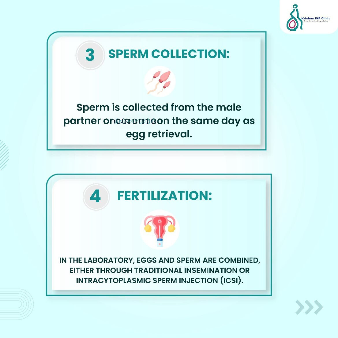 Process of In Vitro Fertilization - Krishna IVF Clinic
